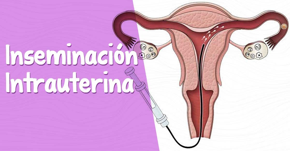 ¿Qué es la Inseminación Artificial? Tips de Salud
